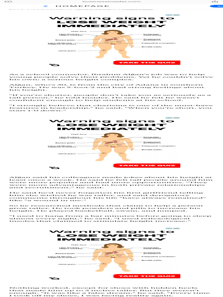 I Paid $27,000 For Leg-Lengthening Surgery As I Hated Jokes About My ...
