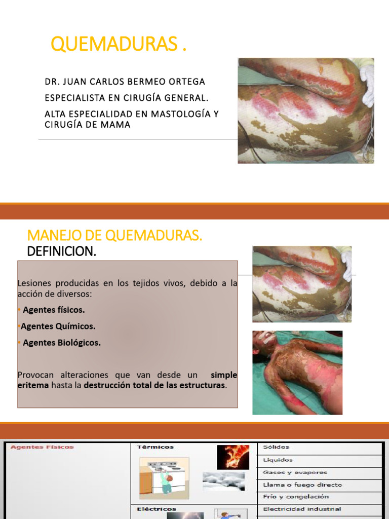 Tema 5 Quemaduras | PDF | Quemar | Medicina CLINICA