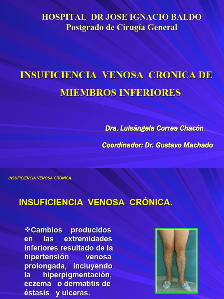 Insuficiencia Venosa Pdf Venas Varicosas Pierna Humana