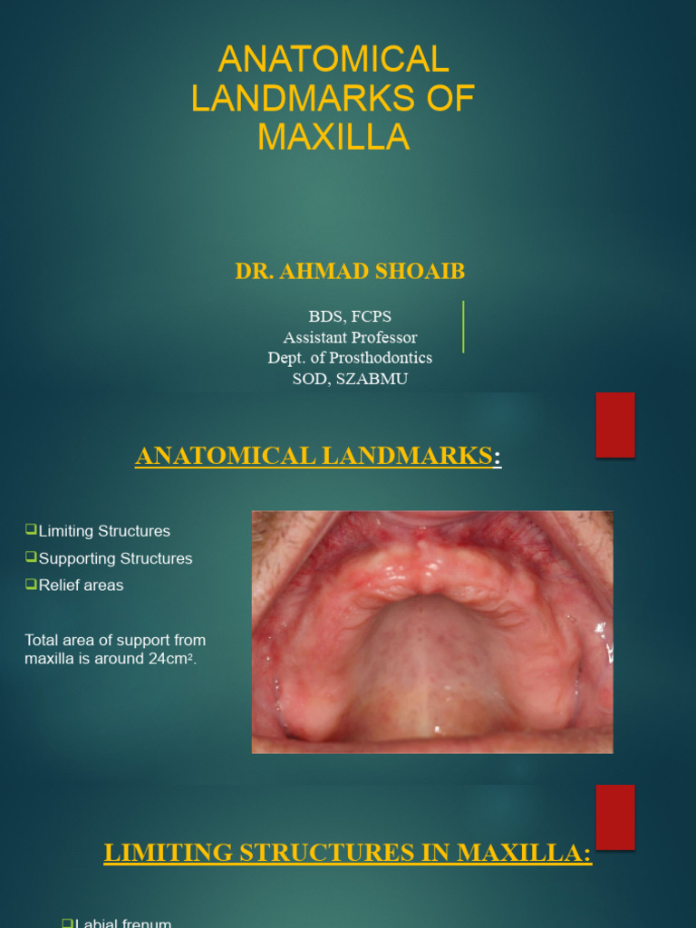 Anatomical landmarks of maxilla | PDF | Dentures | Tooth