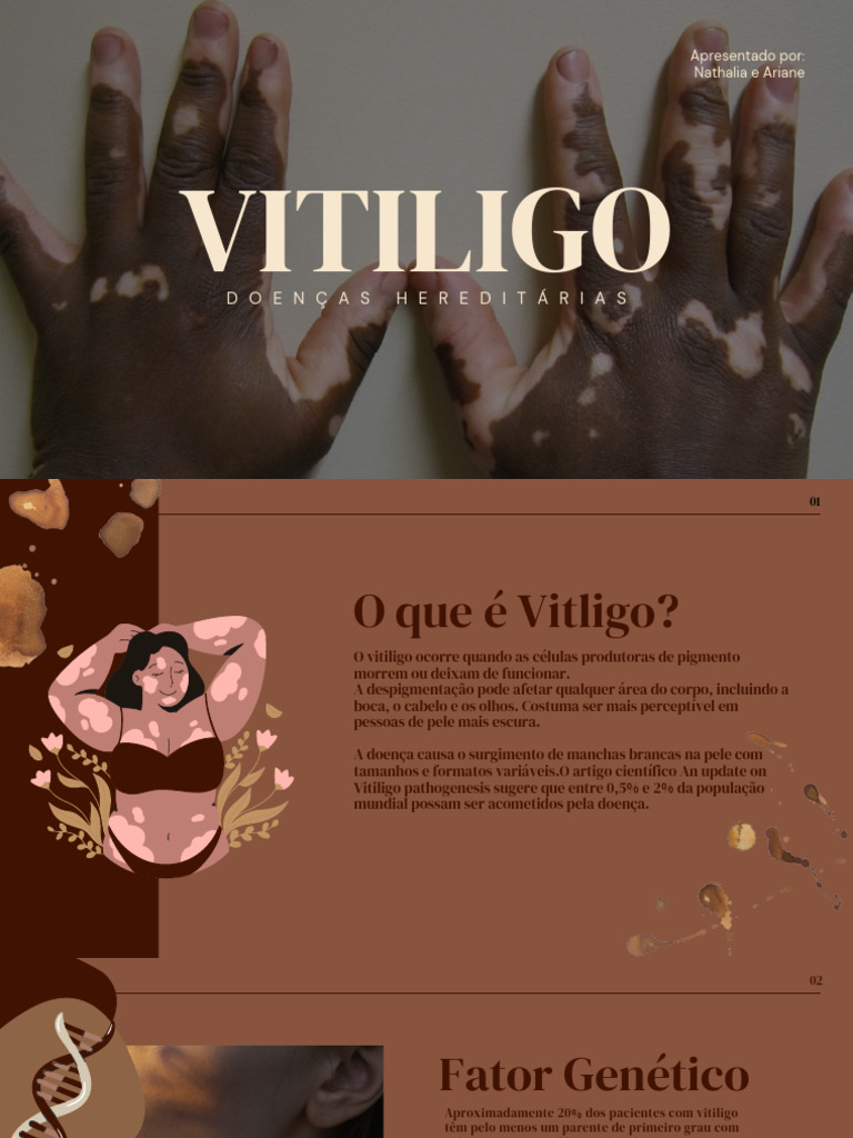 Vitiligo | PDF | Ultravioleta | Medicina Clínica