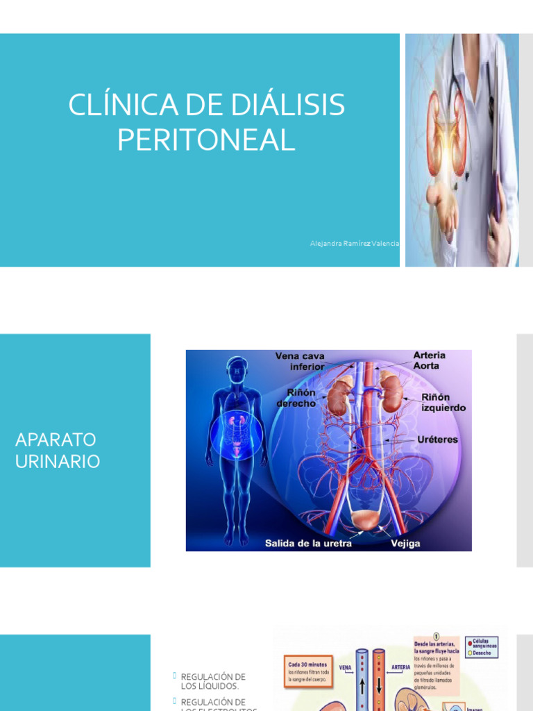Guía Sobre Diálisis Peritoneal Y Complicaciones Pdf Causas De La