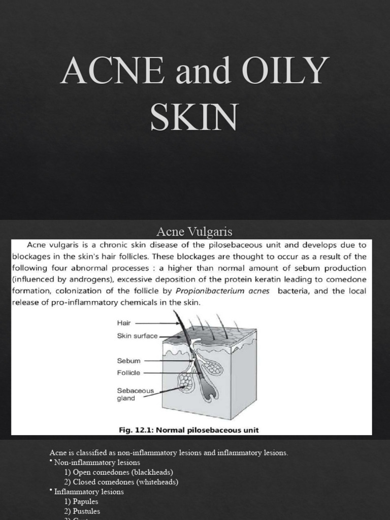 Acne | PDF | Integumentary System | Skin