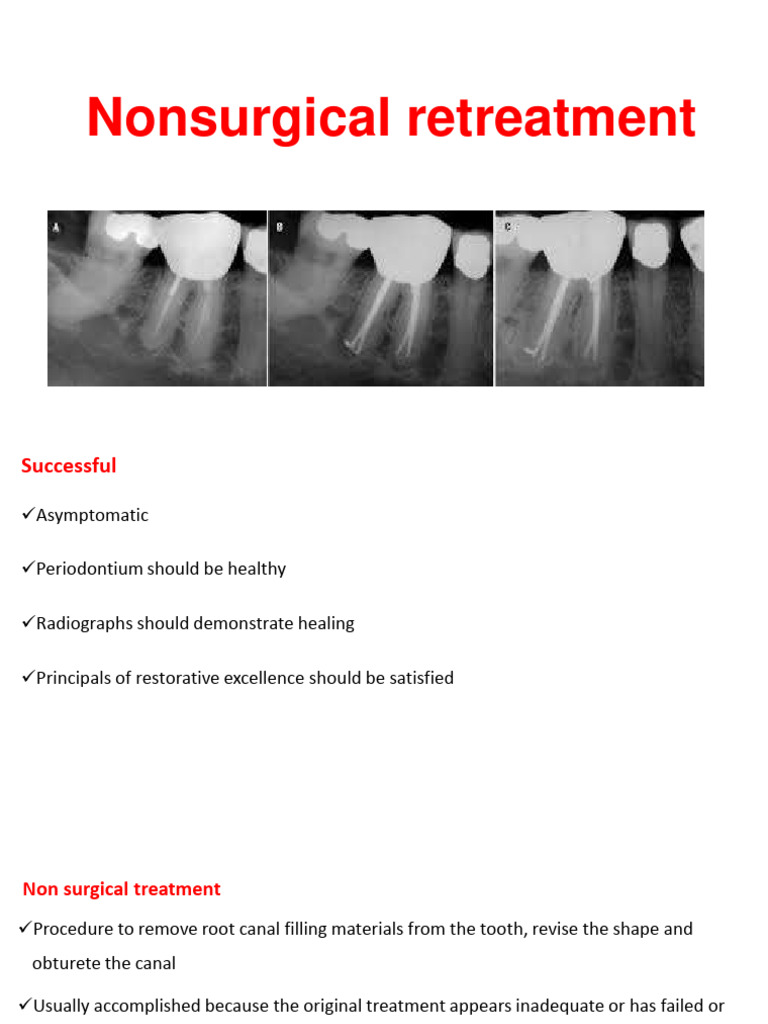 Nonsurgical Endodontic Retreatment Guide | PDF | Mouth | Tooth