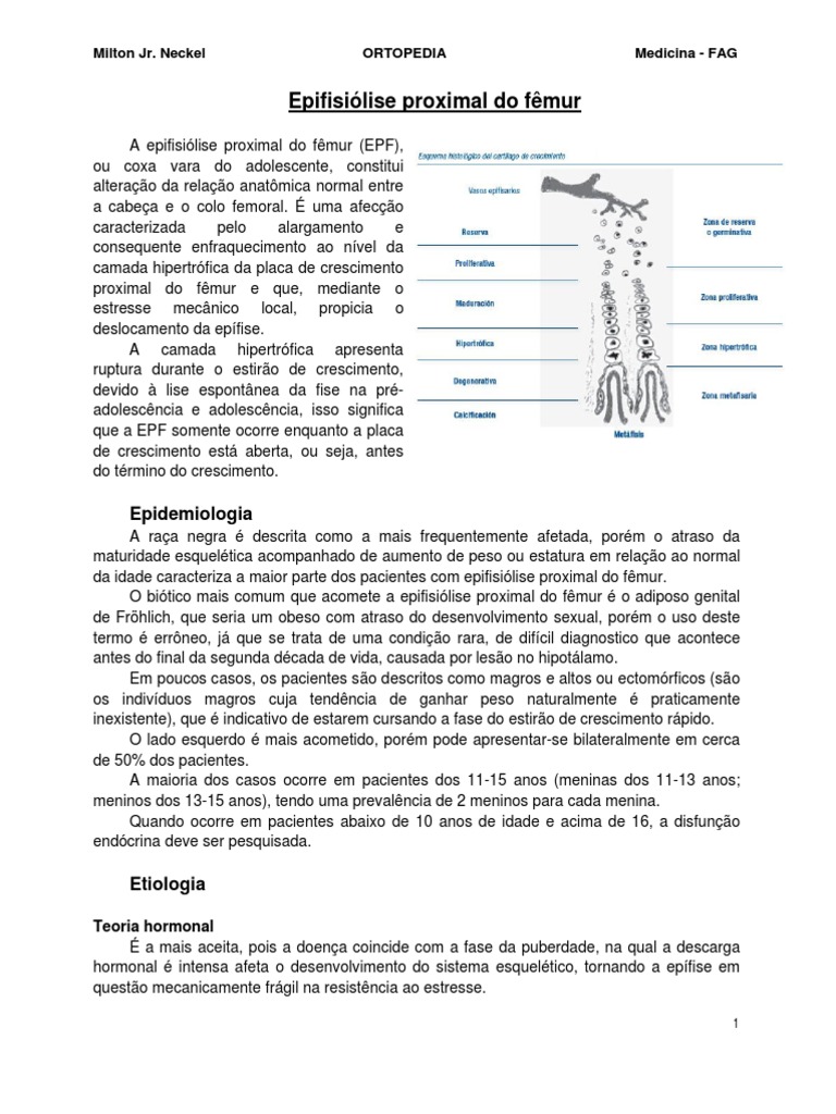 Epifisiólise Proximal do Fêmur: Causas e Diagnóstico | PDF | Remédio ...