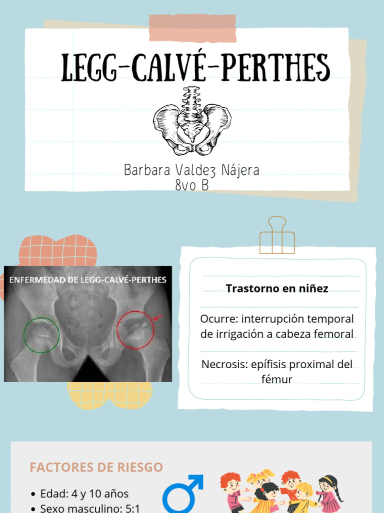Legg Calvé Perthes | PDF | Anatomía del miembro inferior | Sistema musculoesquelético