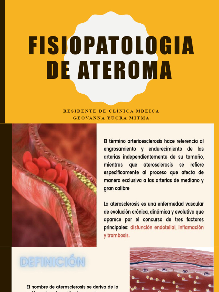 Fisiologoia de Ateroma | PDF