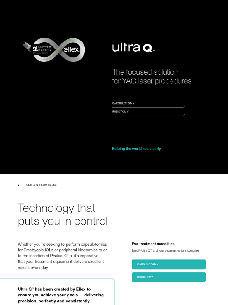 Ultra Q Product Brochure | PDF | Laser | Camera