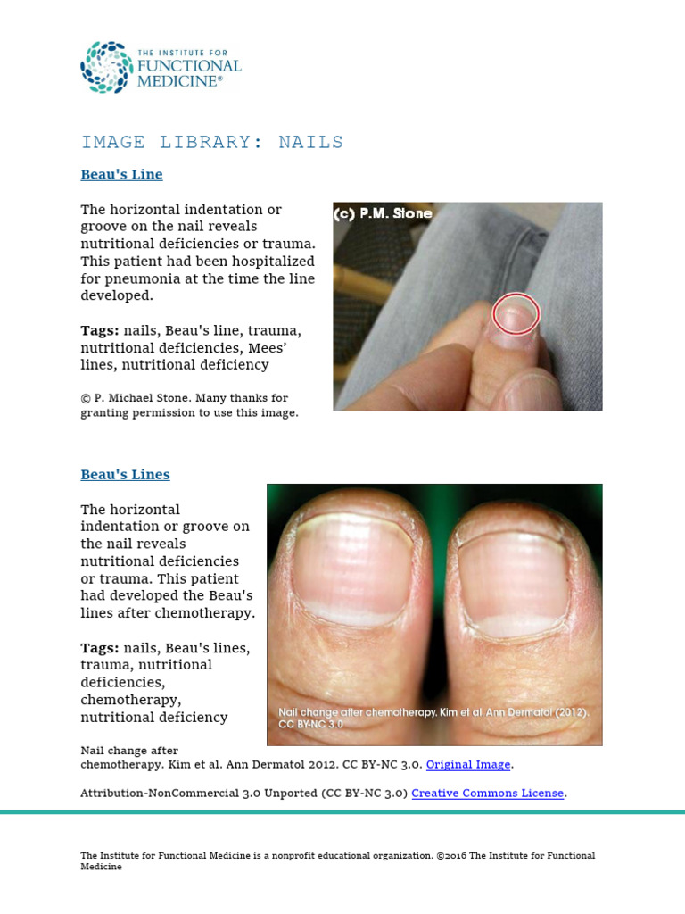 Image_Library_NAILS | PDF | Nail (Anatomy) | Clinical Medicine