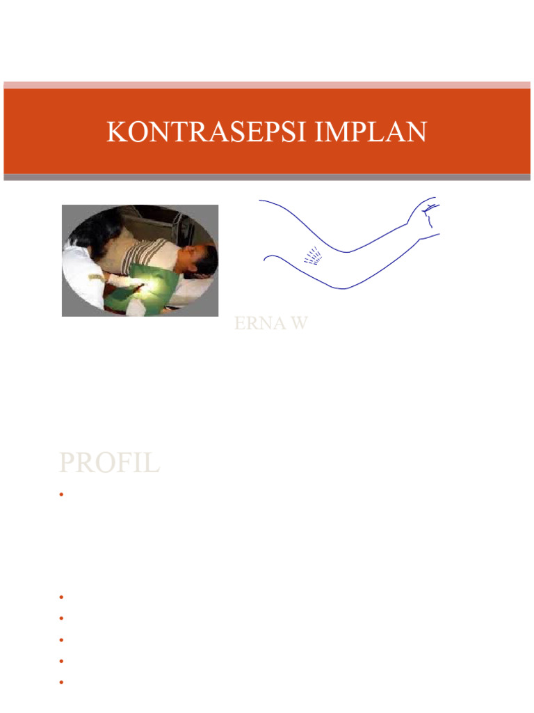 Panduan Kontrasepsi Implan | PDF | Pengembangan Diri | Kesehatan Holistik