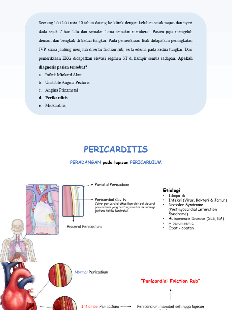 PERIKARDITIS | PDF
