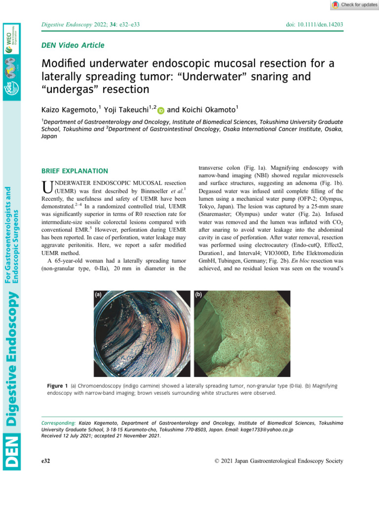 Digestive Endoscopy - 2021 - Kagemoto - Modified Underwater Endoscopic ...