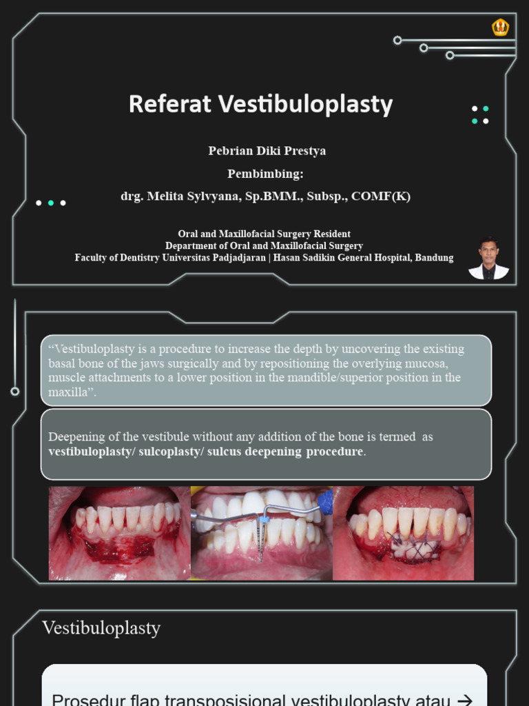 Vestibuloplasty Pebri | PDF | Dentures | Mouth