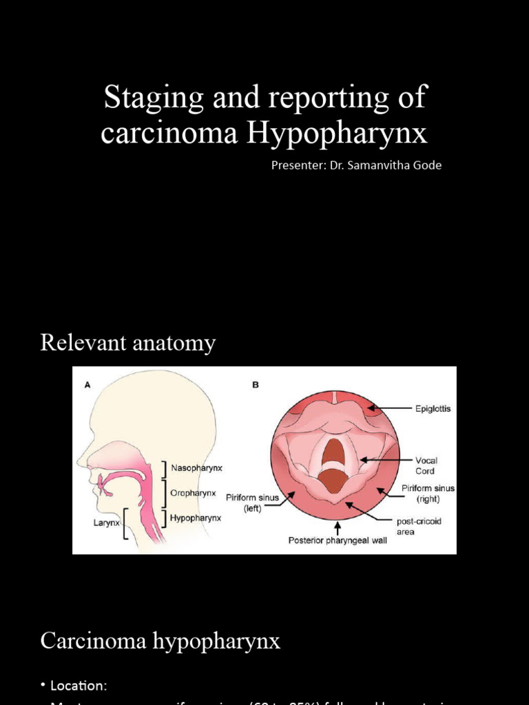 Staging and Reporting of Carcinoma Hypopharynx | Download Free PDF ...