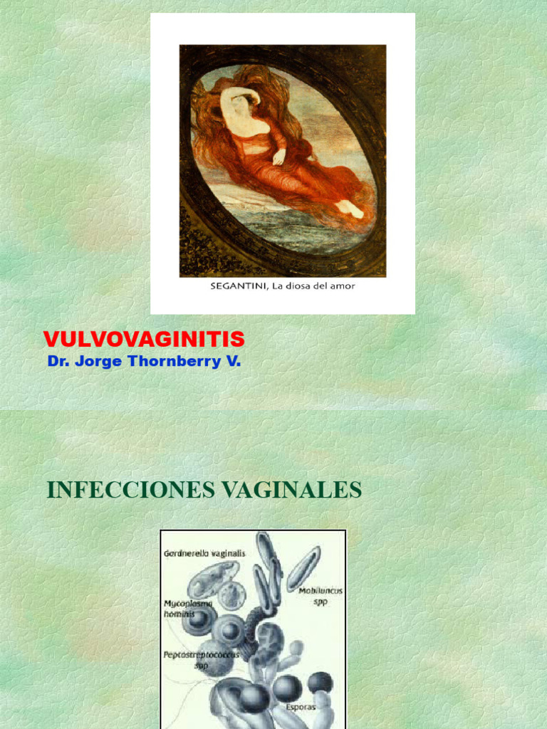 VULVOVAGINITIS | PDF | Candidiasis | Especialidades Medicas