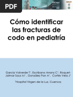 Clasificacion de Gartland 2 | PDF | Sistema musculoesquelético