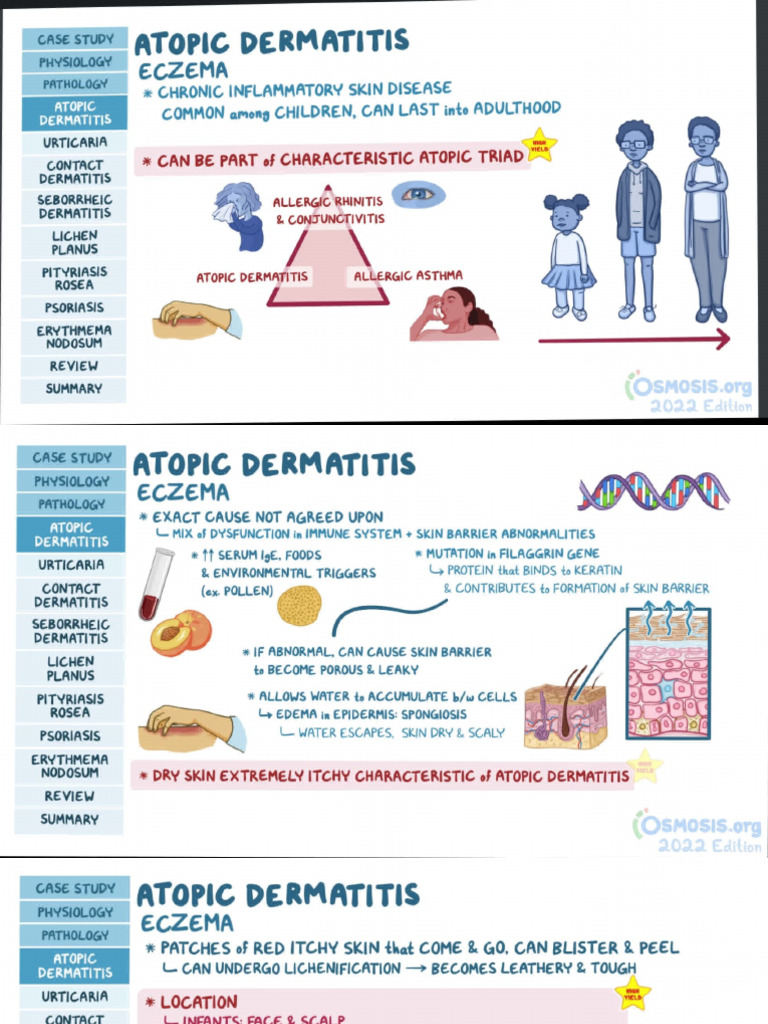 Dermat Review | PDF | Dermatitis | Psoriasis