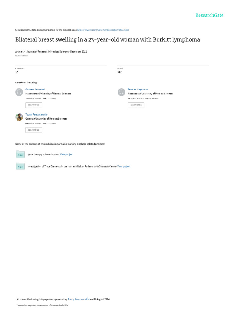 Bilateral Pdf Lymphoma Breast Cancer