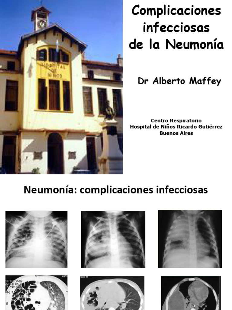 Supuraciones pleuropulmonares y absceso de pulmón (PPT) | PDF ...