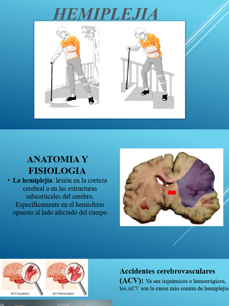 Hemi | PDF | Cerebro | Carrera