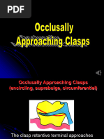 Types and Indications of Clasp Assemblies | PDF | Mouth | Dentistry ...
