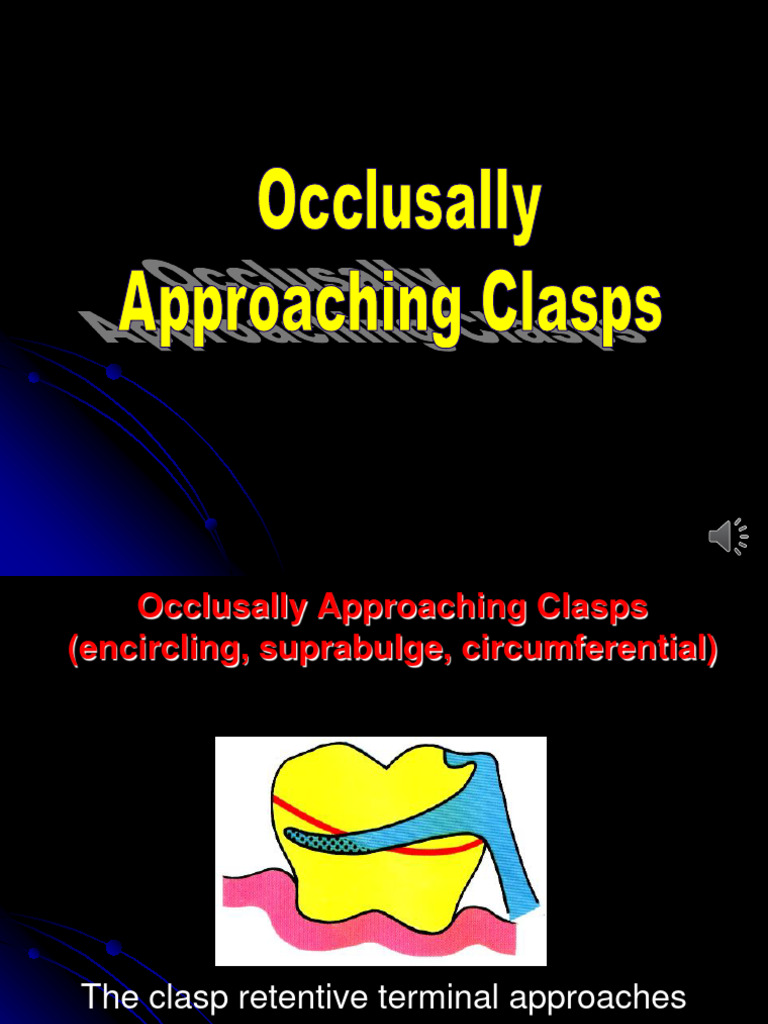 Occlusal Clasp Designs for RPDs | PDF | Dental Anatomy | Mouth