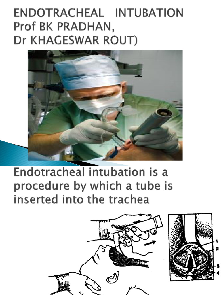 Endotracheal Intubation | PDF | Larynx | Human Head And Neck