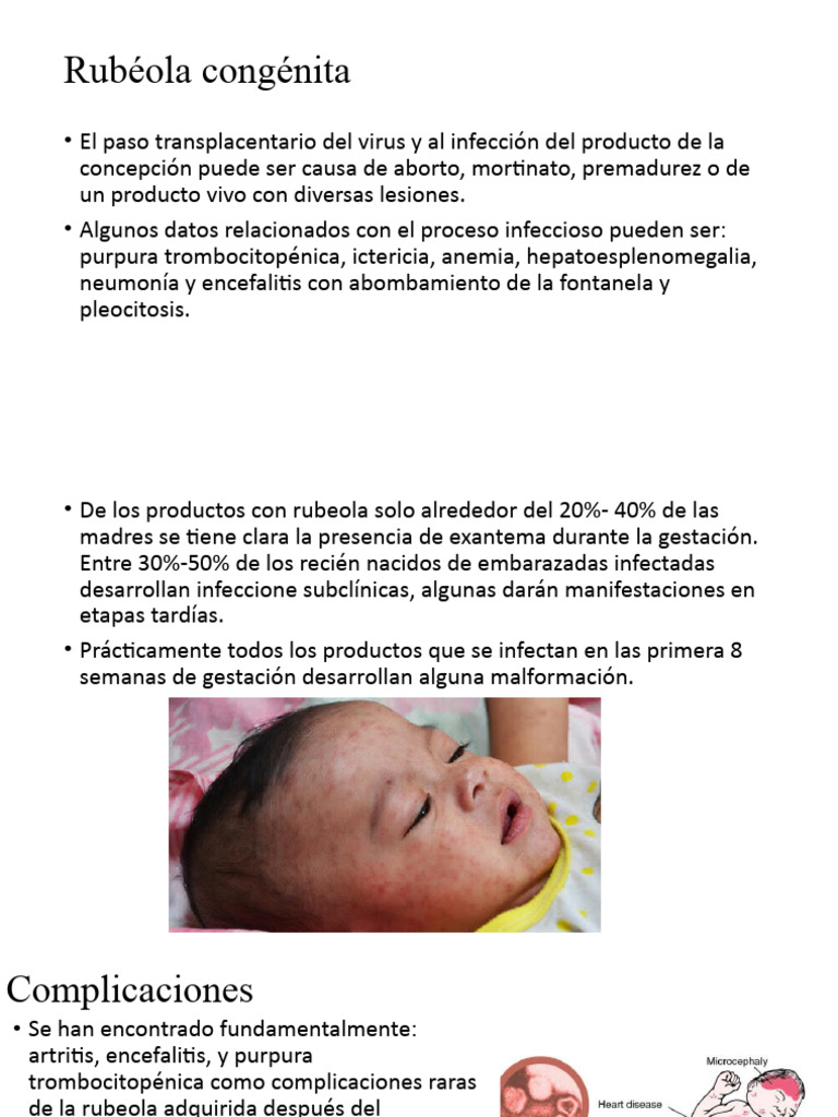 Rubéola congénita | PDF | Enfermedades y trastornos humanos | Ciencias ...