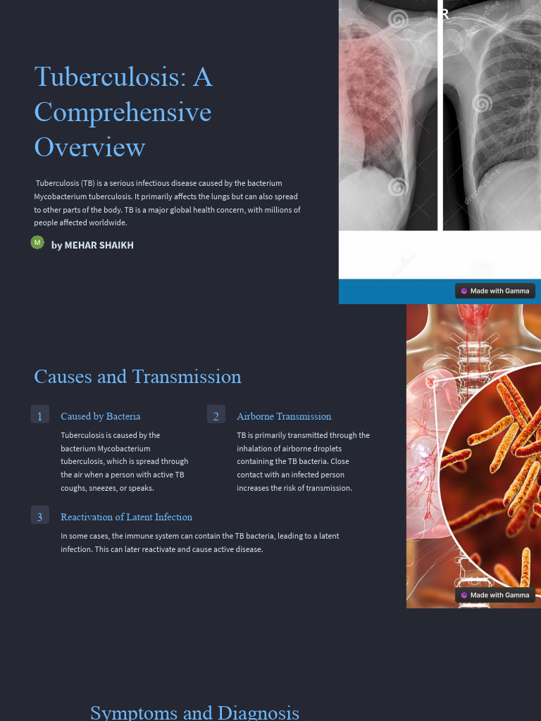 Tuberculosis A Comprehensive Overview | PDF | Tuberculosis | Mycobacterium Tuberculosis