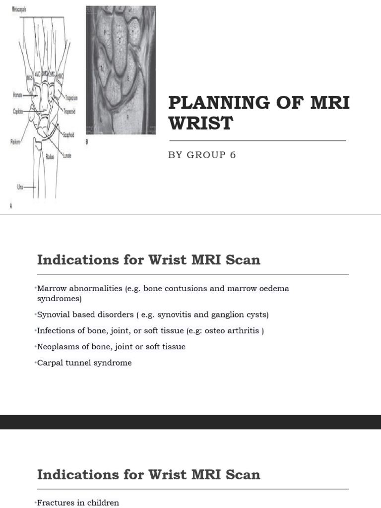 Planning of Mri Wrist | Download Free PDF | Magnetic Resonance Imaging ...