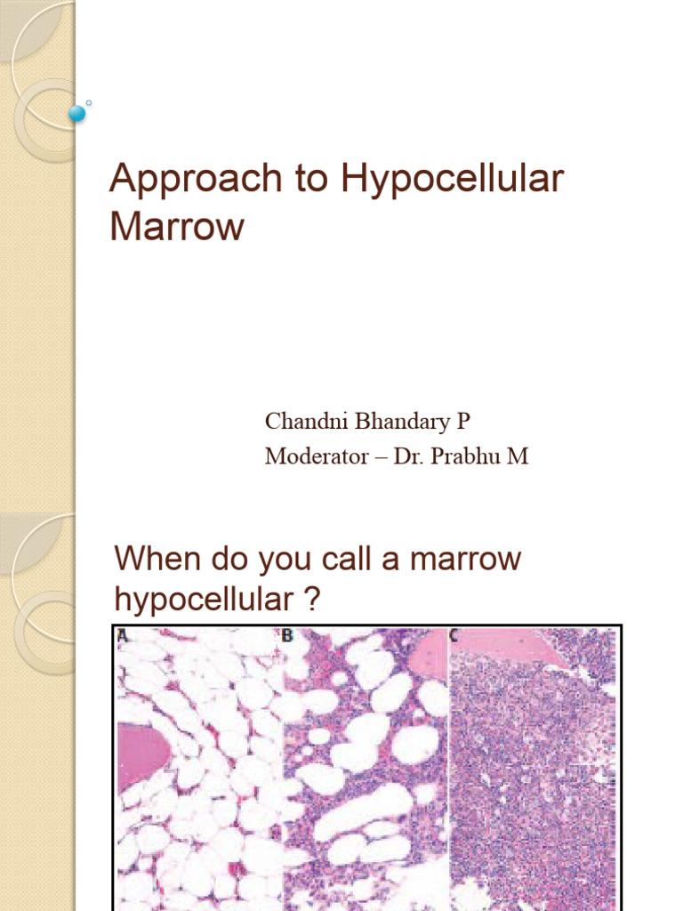 Approach To Hypocellular Marrow | PDF | Anemia | Blood