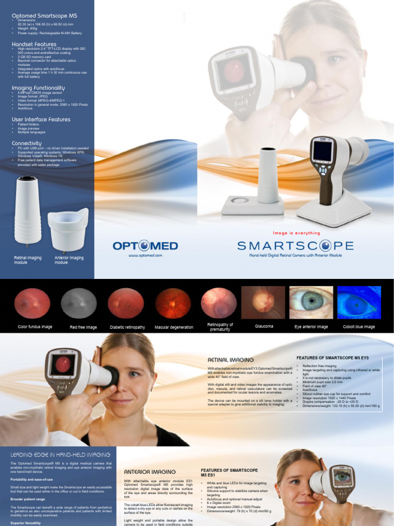 Smart Scope Ophthalmology | PDF | Image Resolution | Camera