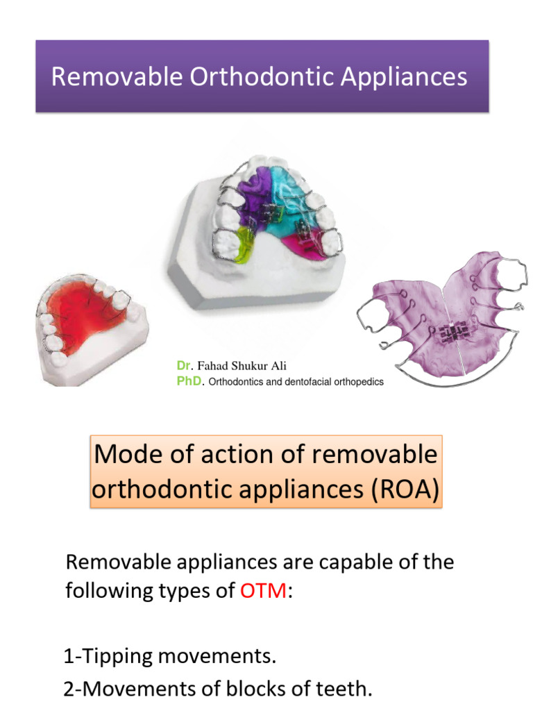 Overview of Removable Orthodontic Appliances | PDF | Orthodontics | Mouth