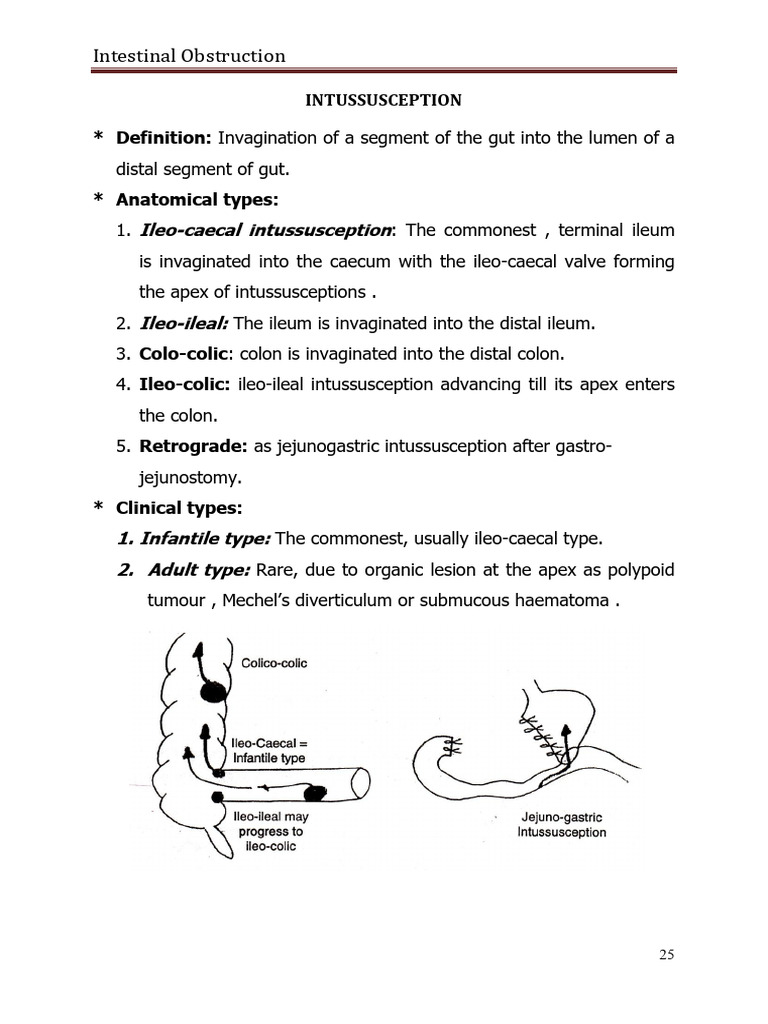 Intestinal Obstruction | PDF | Digestive Diseases | Clinical Medicine