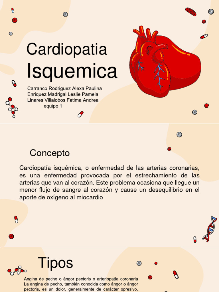 Clasificación y tratamiento de cardiopatía isquémica | PDF | Isquemia ...