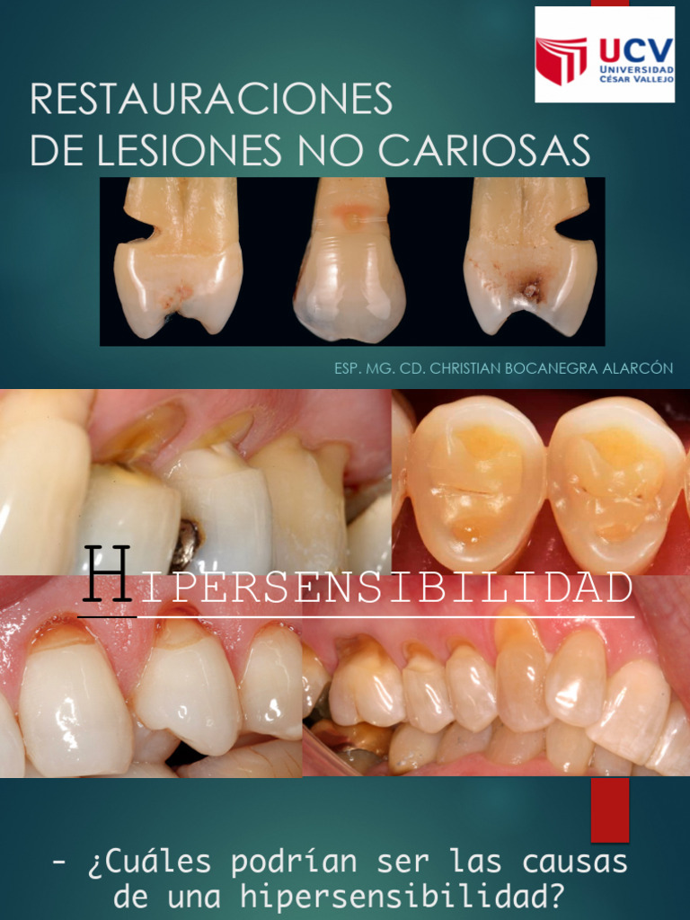 Clase 5 lesiones no cariosas | PDF