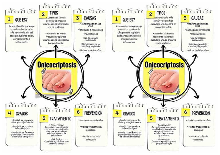 Resumen Onicocriptosis | PDF