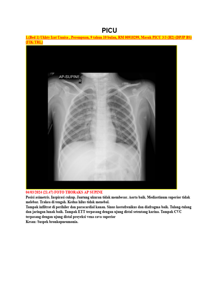 Diagnosa Pneumonia dan CVC Terpasang | PDF
