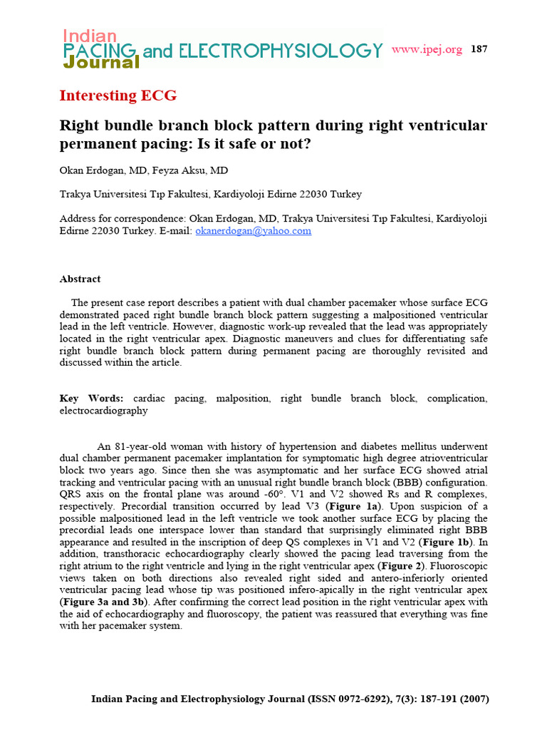 Interesting ECG | PDF | Artificial Cardiac Pacemaker | Electrocardiography