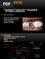 Teorías de Caries y Triada de Keyes | PDF | Las bacterias | Diente