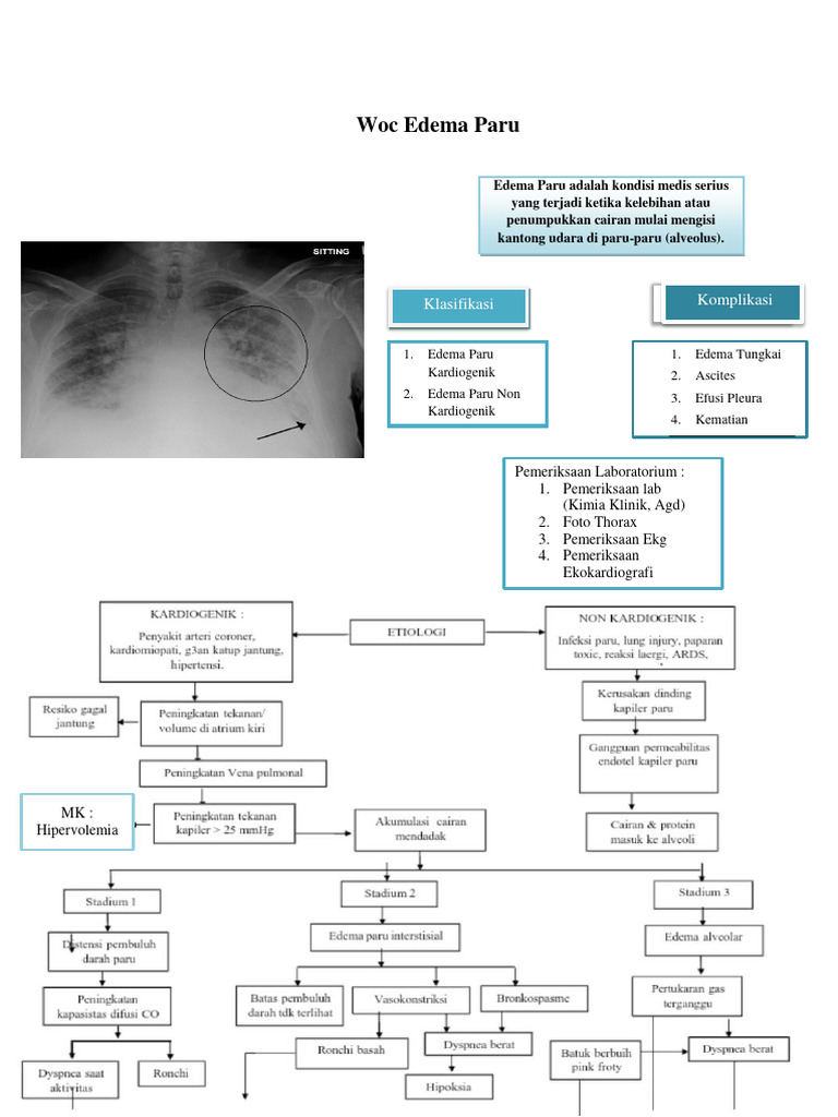 Edema Paru Rika | PDF