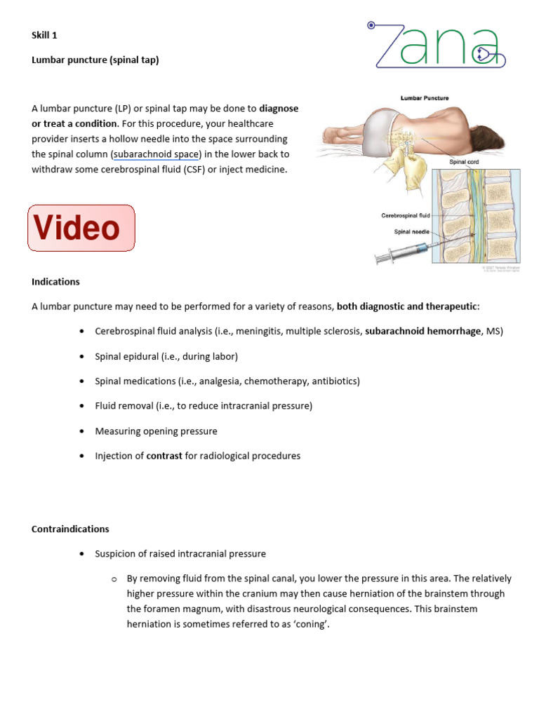 Skills 1 (Lumbar Puncture) | PDF | Cerebrospinal Fluid | Neurology
