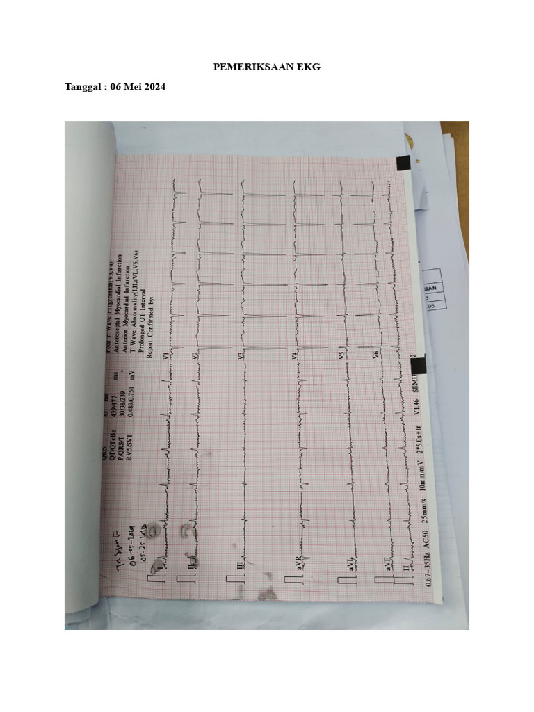 Ekg Pak Syarif | PDF | Sains & Matematika