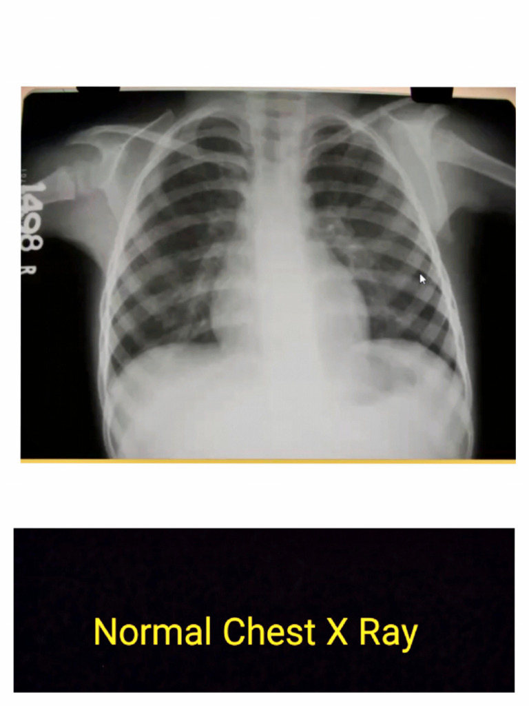 Paediatrics X-Rays-1 | PDF