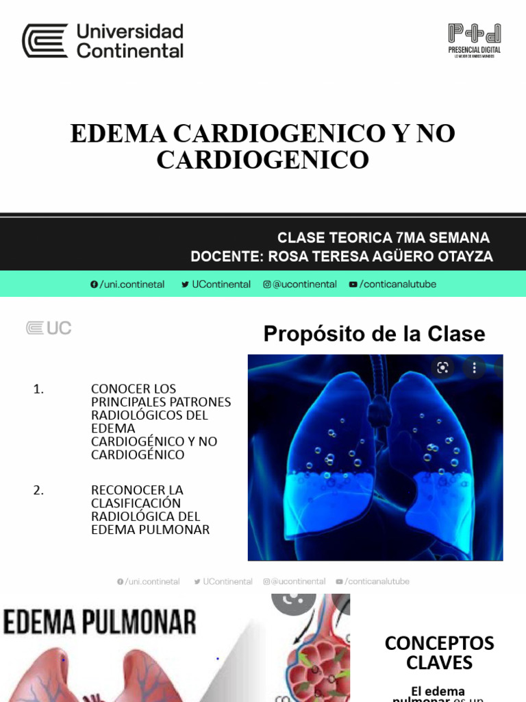 EDEMA PULMONAR CARDIOGÉNICO Y NO CARDIOGÉNICO | PDF | Edema ...
