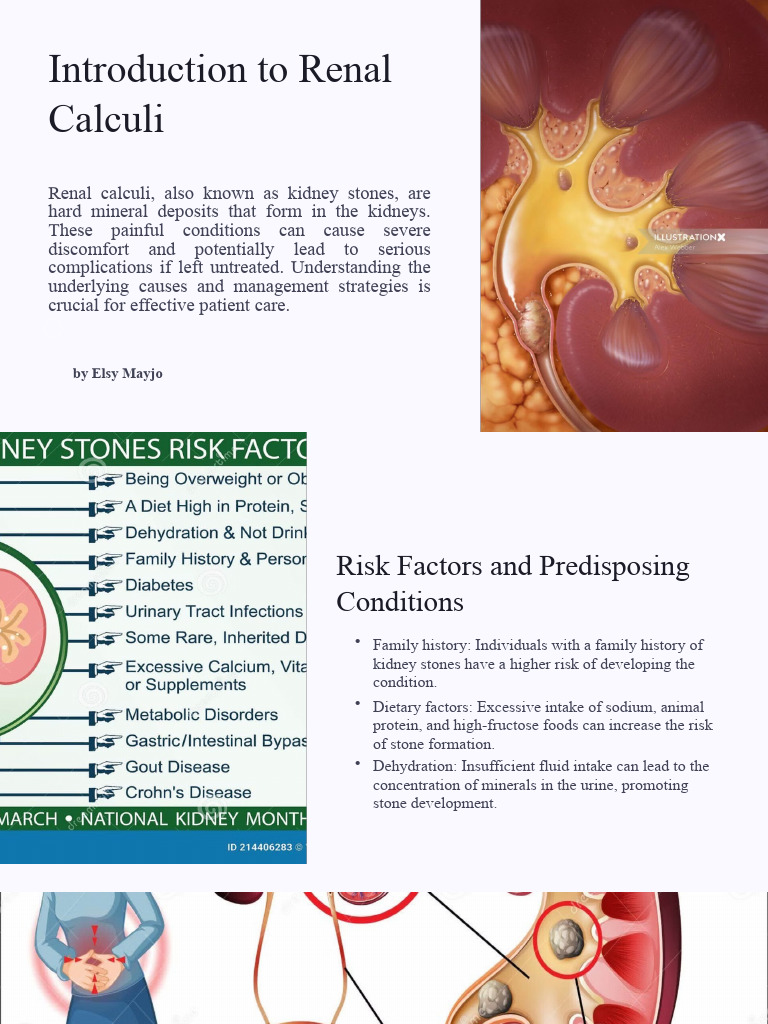 Renal Calculi | Download Free PDF | Diseases And Disorders | Urology