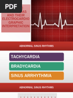 Ecg MCQS | PDF | Electrocardiography | Cardiology