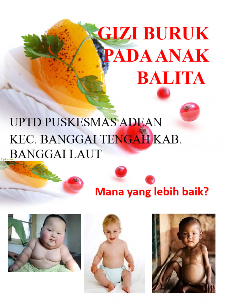 Gizi Buruk | PDF | Pengembangan Diri | Gaya Hidup