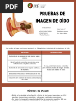 Otoscopia Normal | PDF | Oído | Anatomía