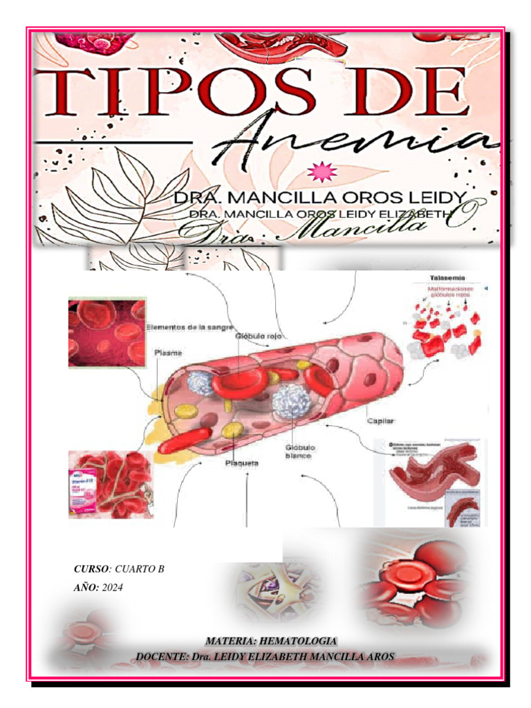 Tipos de anemia | PDF | Anemia | Glóbulo rojo